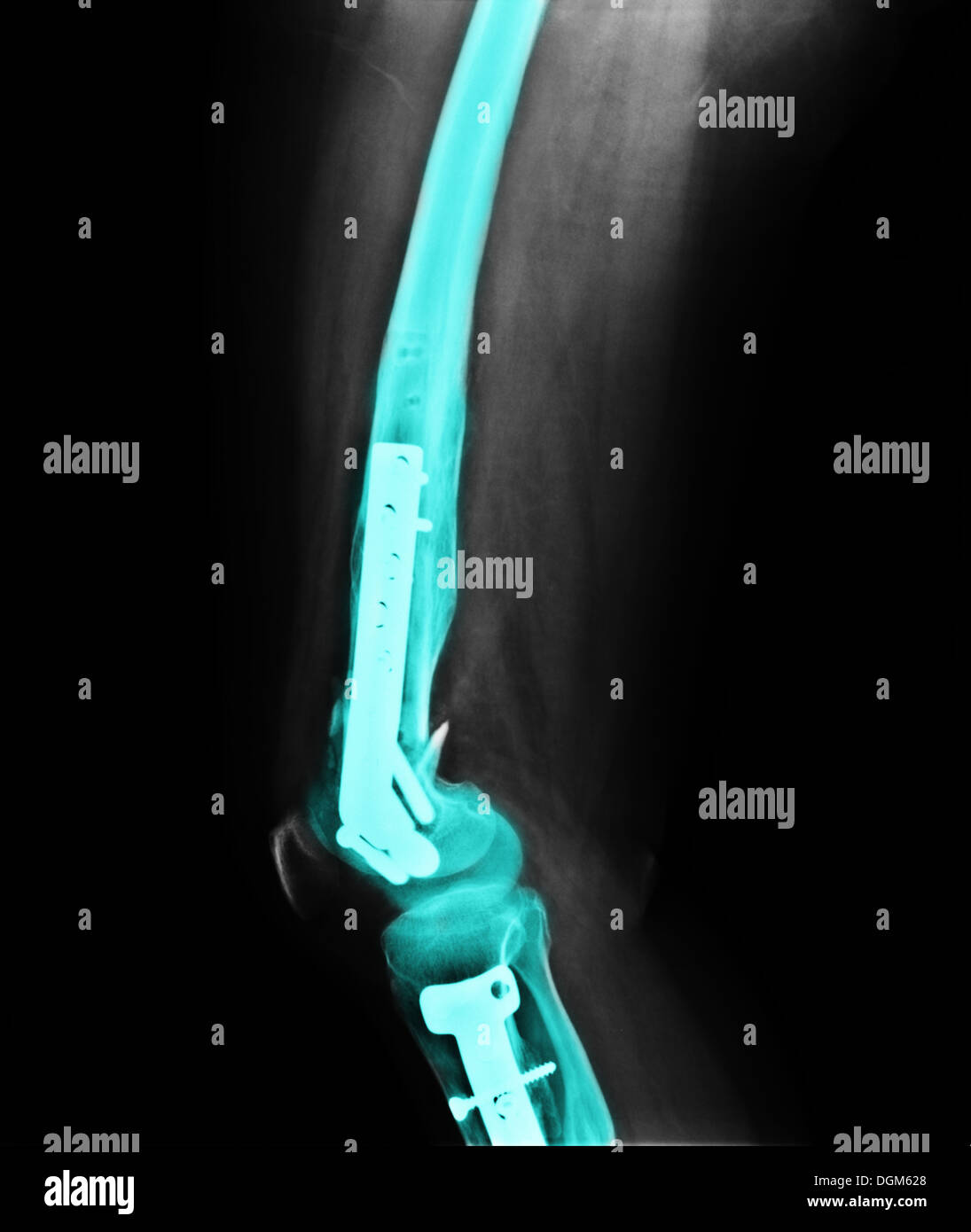 X-radiation (composed of X-rays) is a form of electromagnetic radiation ...