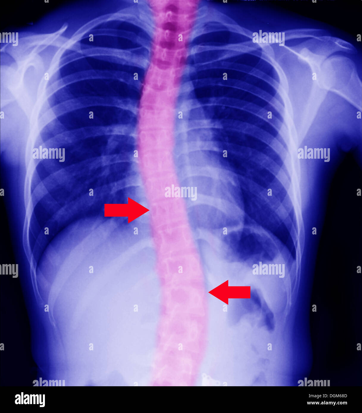 X-radiation (composed of X-rays) is a form of electromagnetic radiation ...