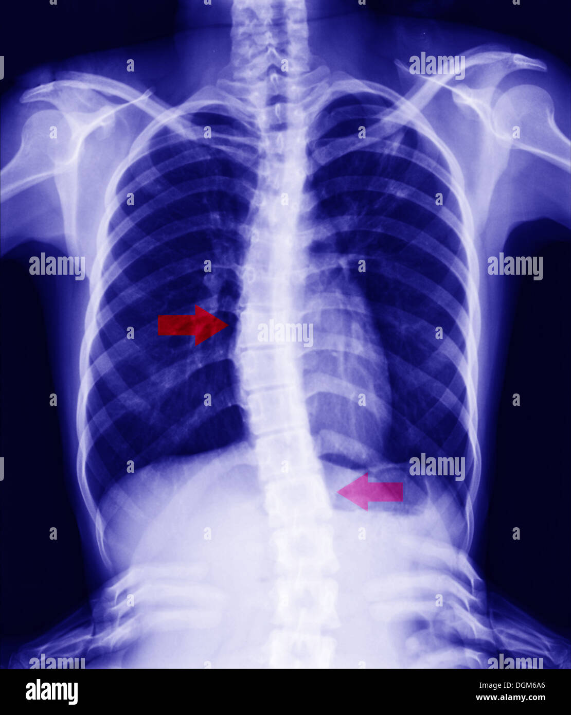 X-radiation (composed of X-rays) is a form of electromagnetic radiation ...