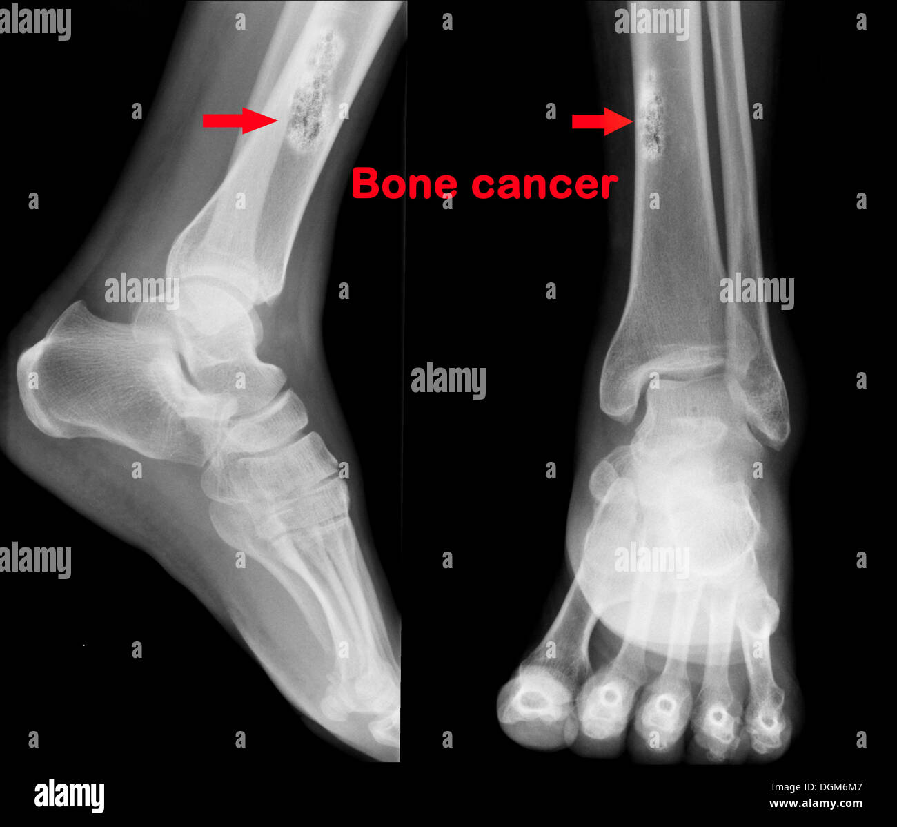 X-radiation (composed of X-rays) is a form of electromagnetic radiation ...