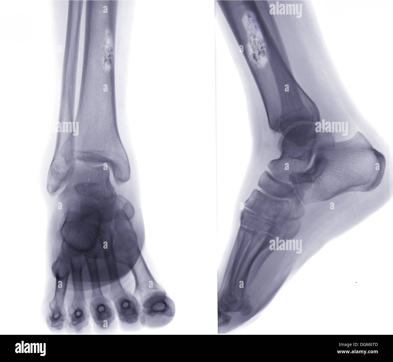 X-radiation (composed of X-rays) is a form of electromagnetic radiation ...