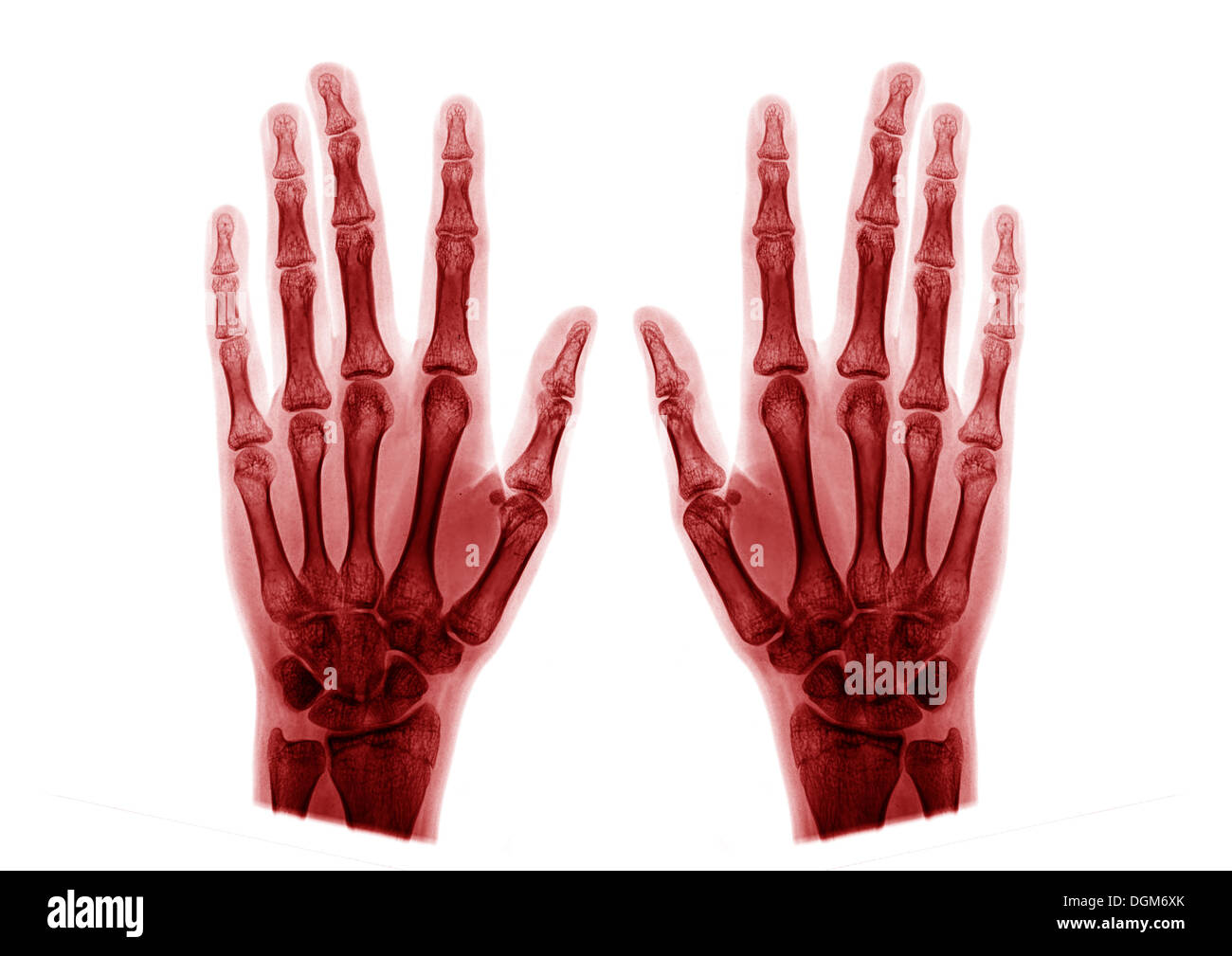 X-radiation (composed of X-rays) is a form of electromagnetic radiation ...