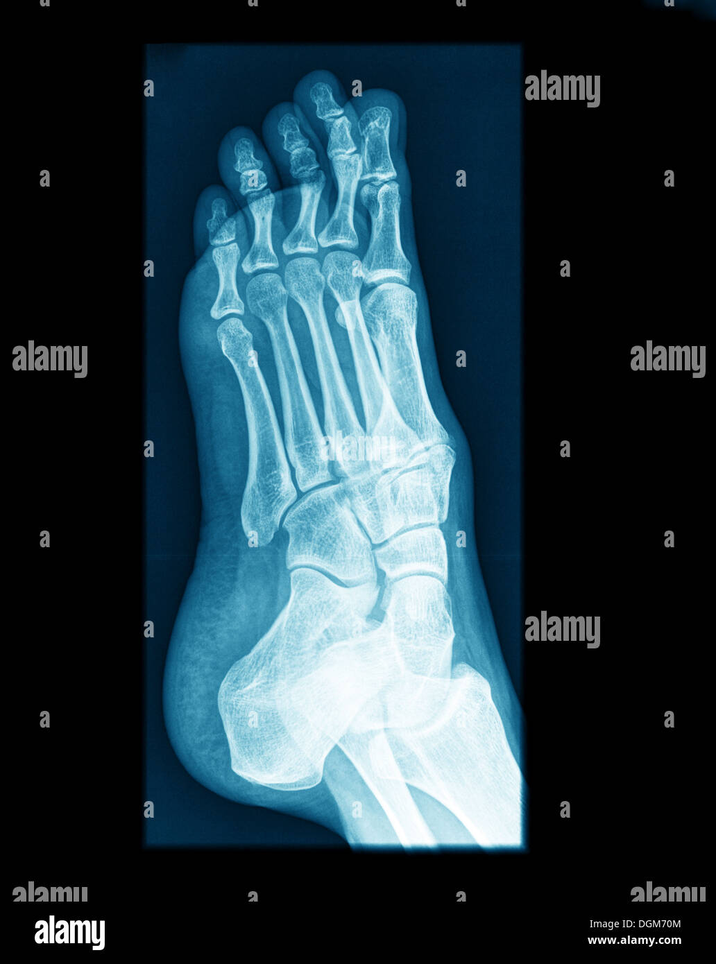 X-radiation (composed of X-rays) is a form of electromagnetic radiation ...