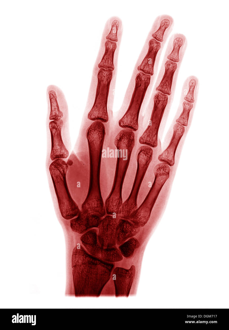 X-radiation (composed of X-rays) is a form of electromagnetic radiation ...