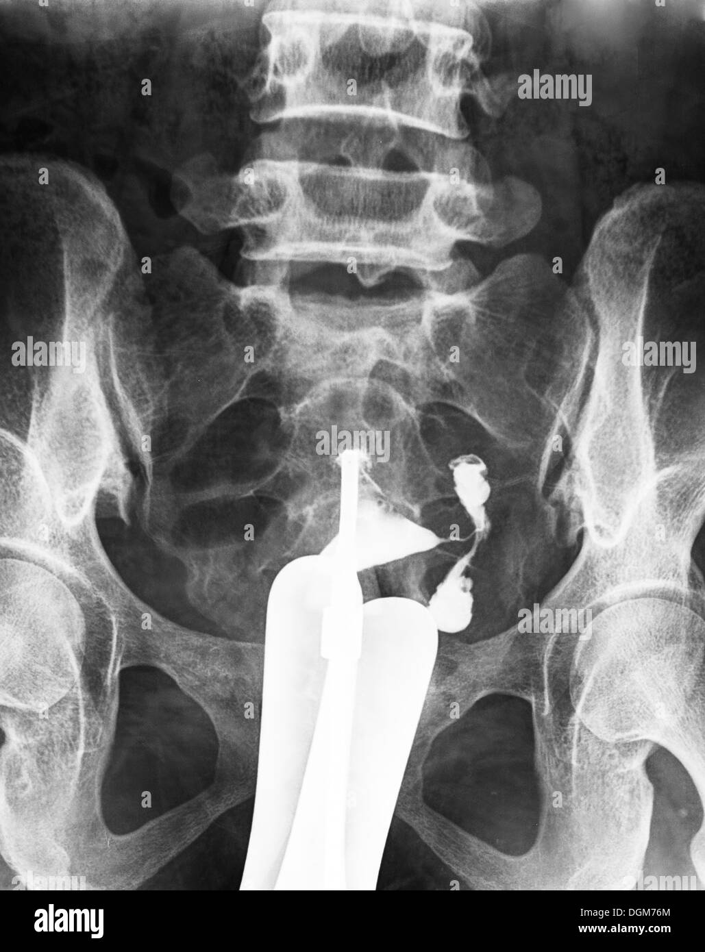 X-radiation (composed of X-rays) is a form of electromagnetic radiation ...