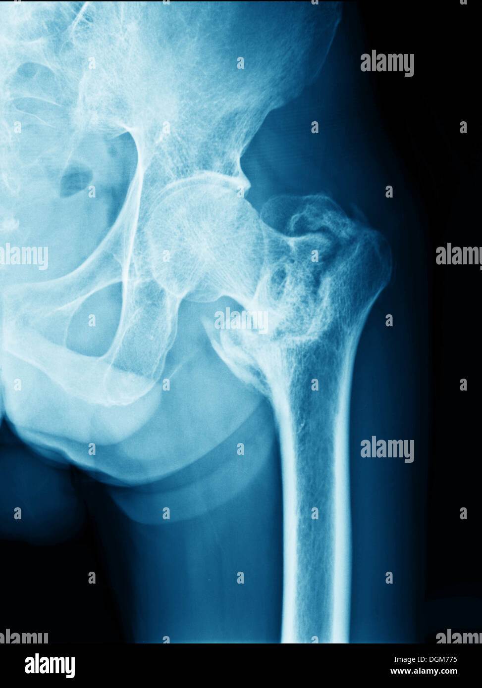 X-radiation (composed of X-rays) is a form of electromagnetic radiation ...