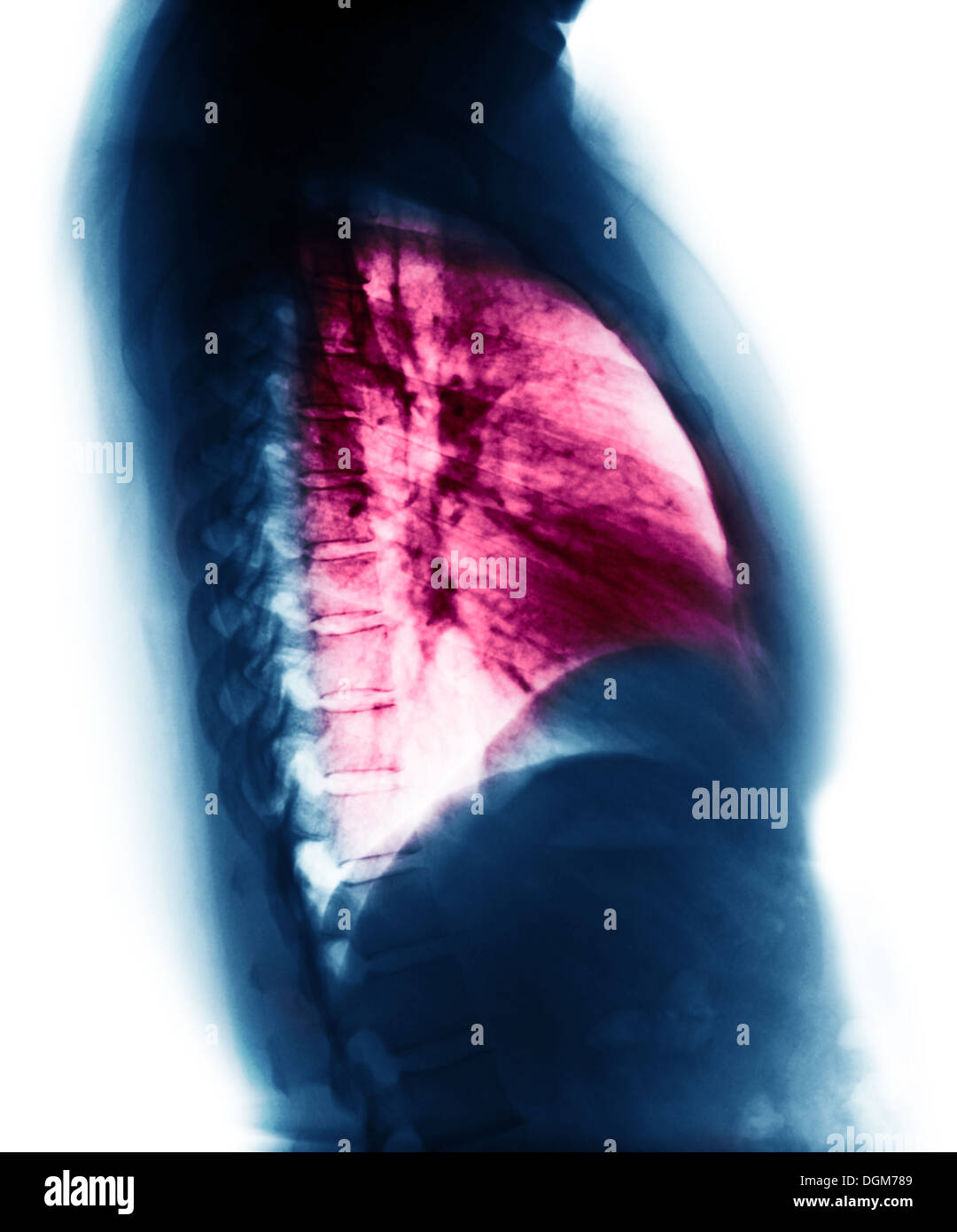 X-radiation (composed of X-rays) is a form of electromagnetic radiation ...
