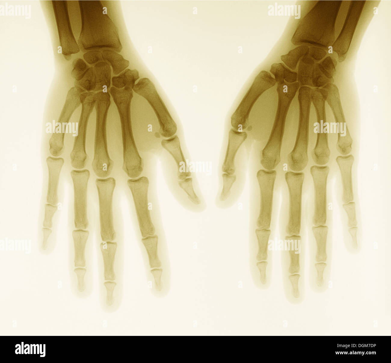 X-radiation (composed of X-rays) is a form of electromagnetic radiation ...