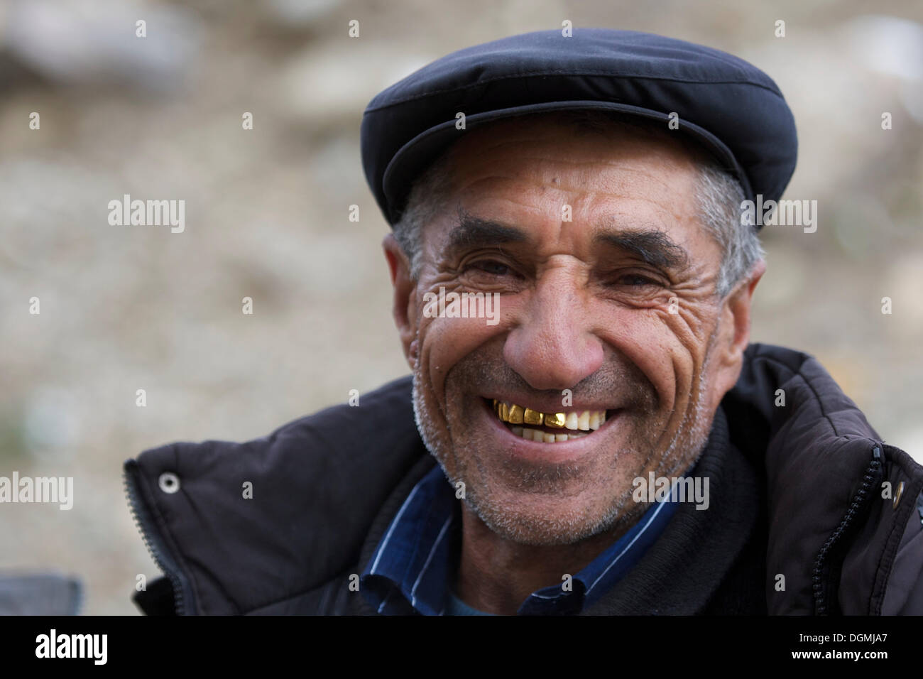 Gold teeth hi-res stock photography and images - Alamy