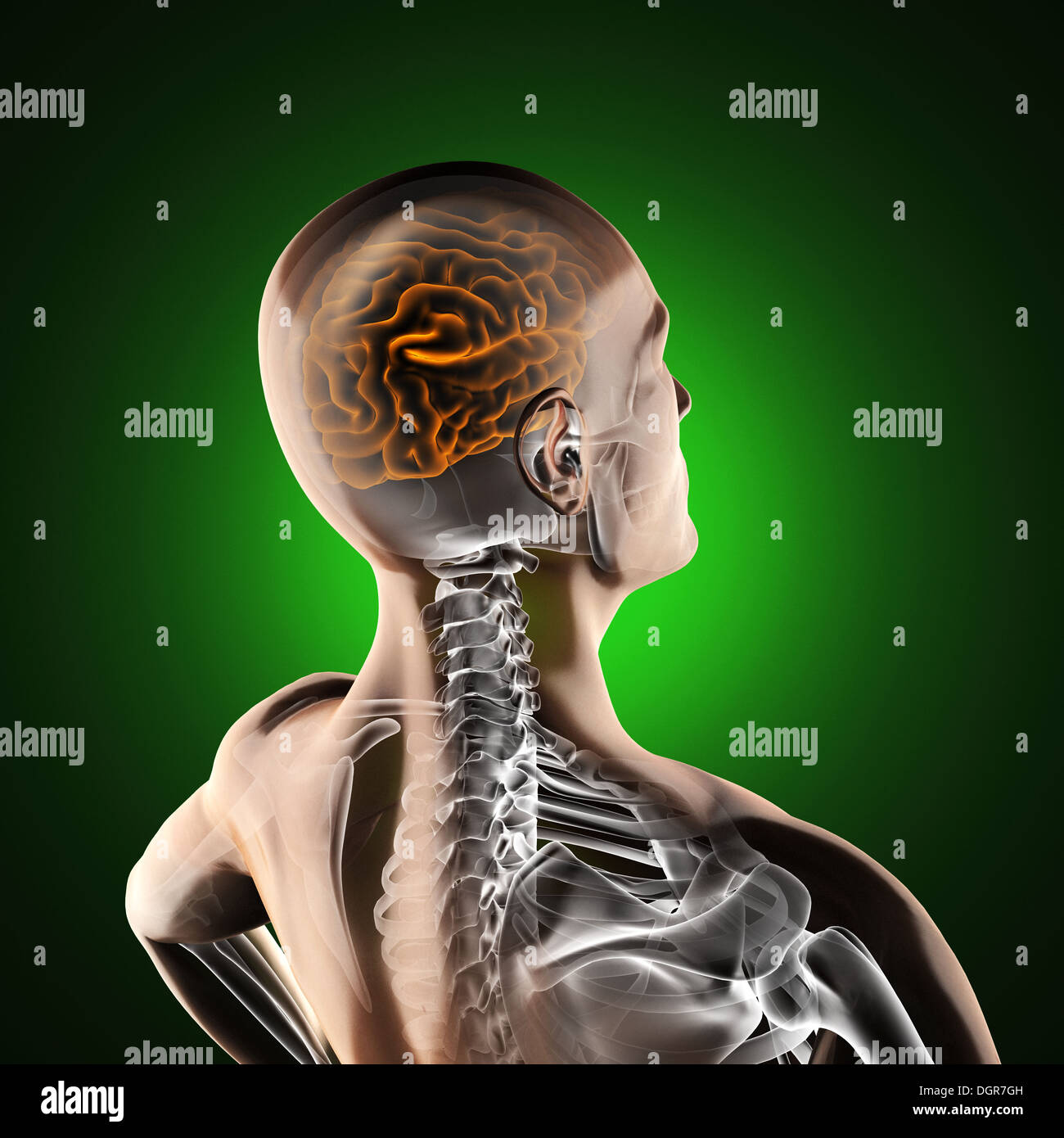 human brain radiography scan Stock Photo - Alamy