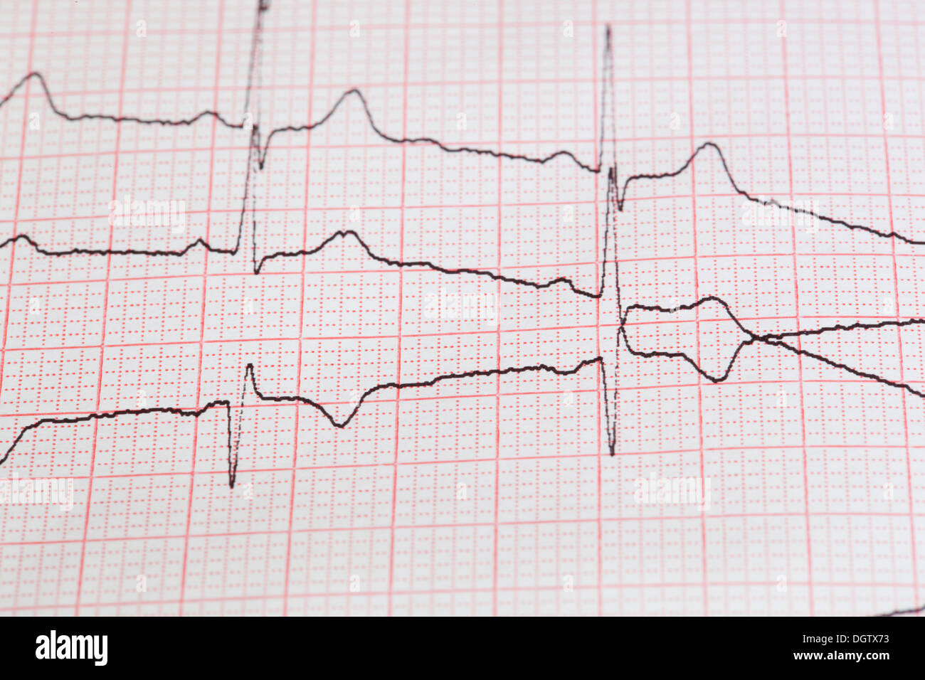 Electro cardiogram hi-res stock photography and images - Alamy
