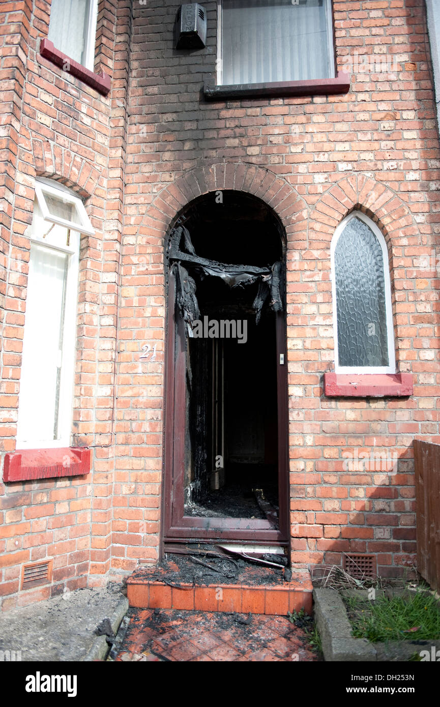Severe burn hi-res stock photography and images - Alamy