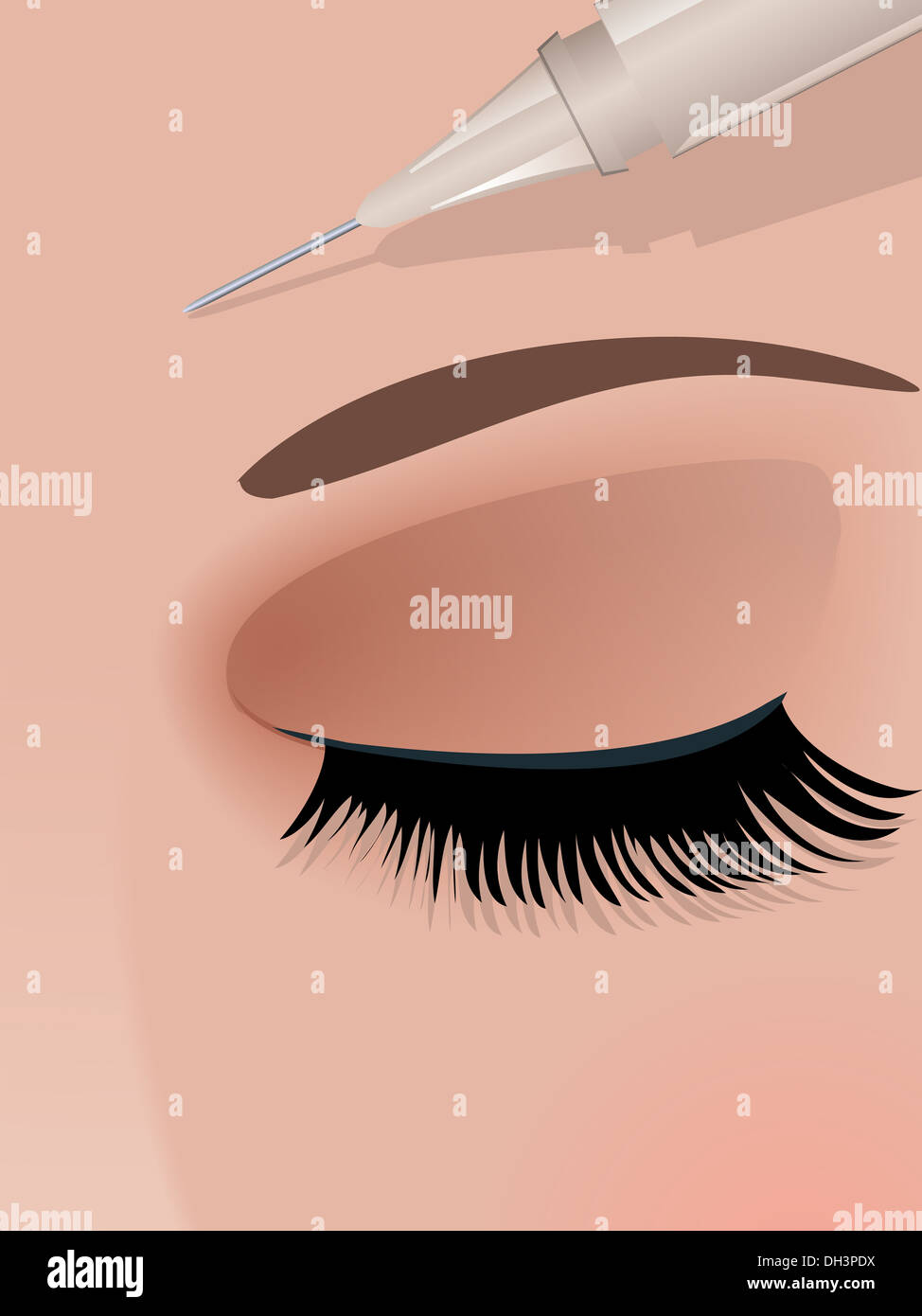 Close up of needle about to give botox injection into the forehead of ...