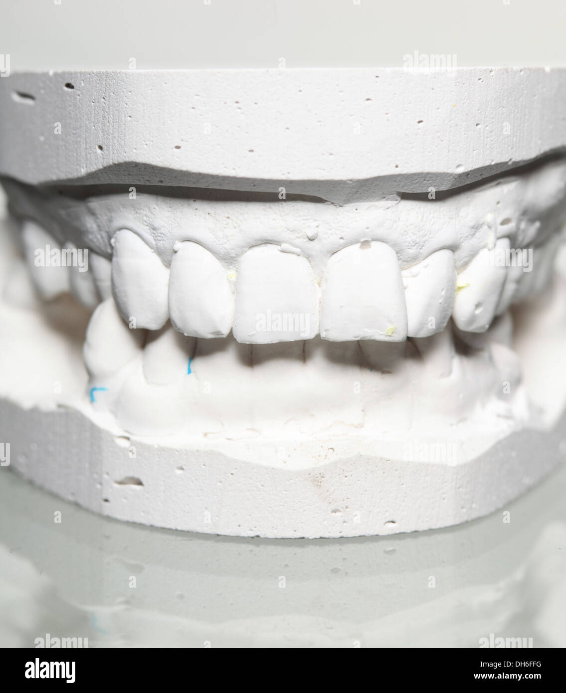 Dental casting gypsum model plaster cast stomatologic human jaws ...