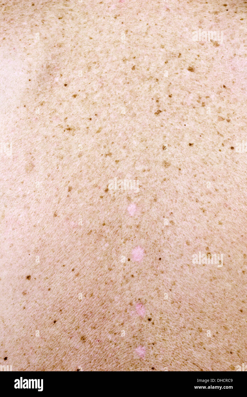 Female surface anatomy hi-res stock photography and images - Alamy