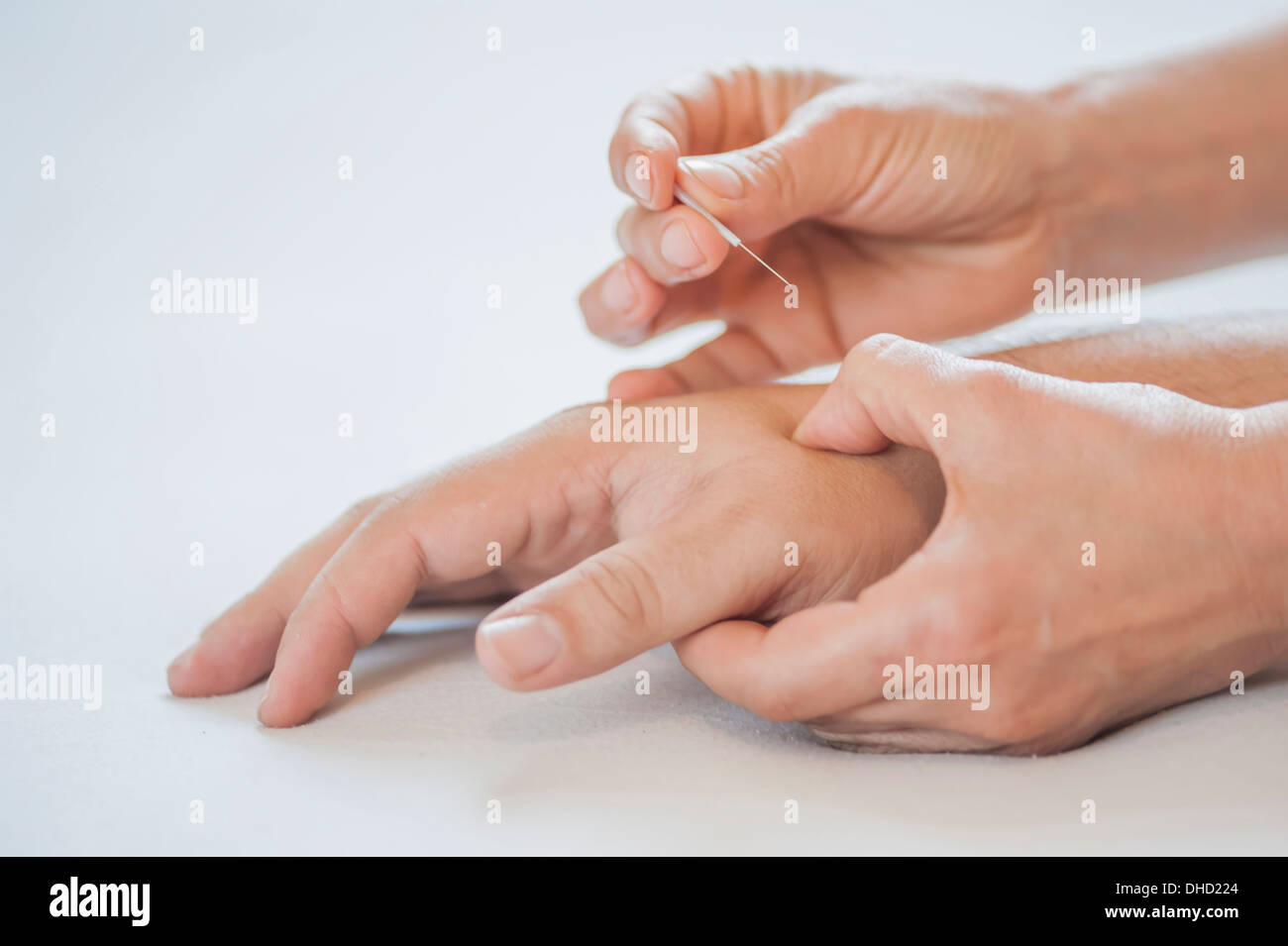 Traditional Chinese Medicine, TCM, acupuncture, hand with acupuncture ...