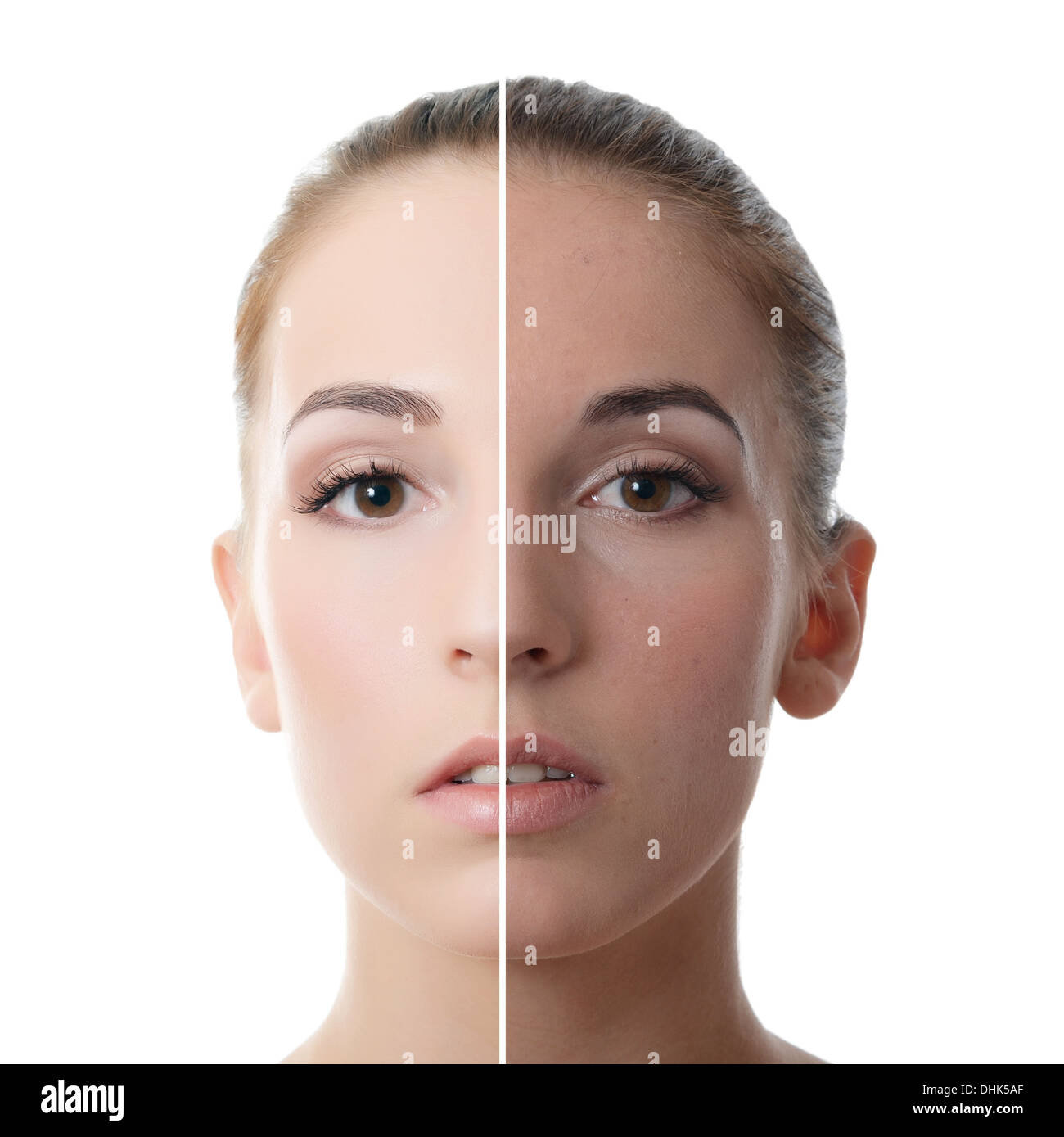 Beautiful girl with problems on face Stock Photo - Alamy