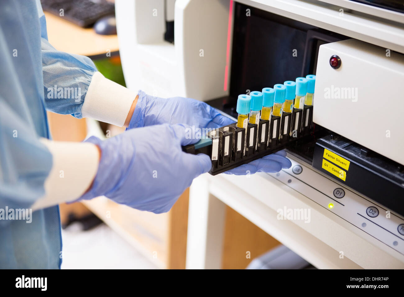 Coagulation Test Analysis Stock Photo - Alamy
