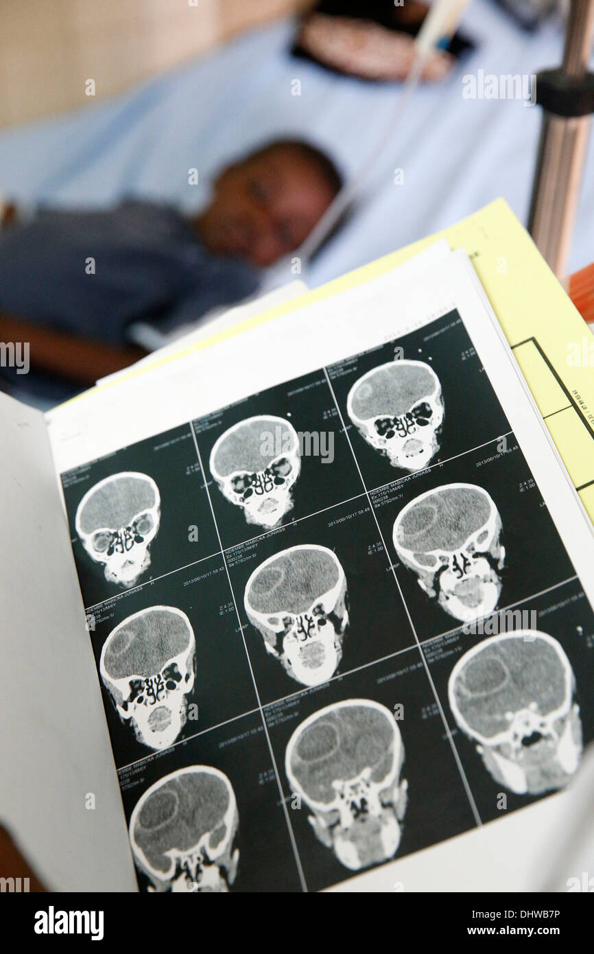 Ct scan child hi-res stock photography and images - Alamy