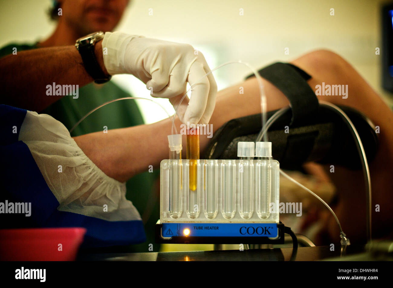 Ivf surgery hi-res stock photography and images - Alamy