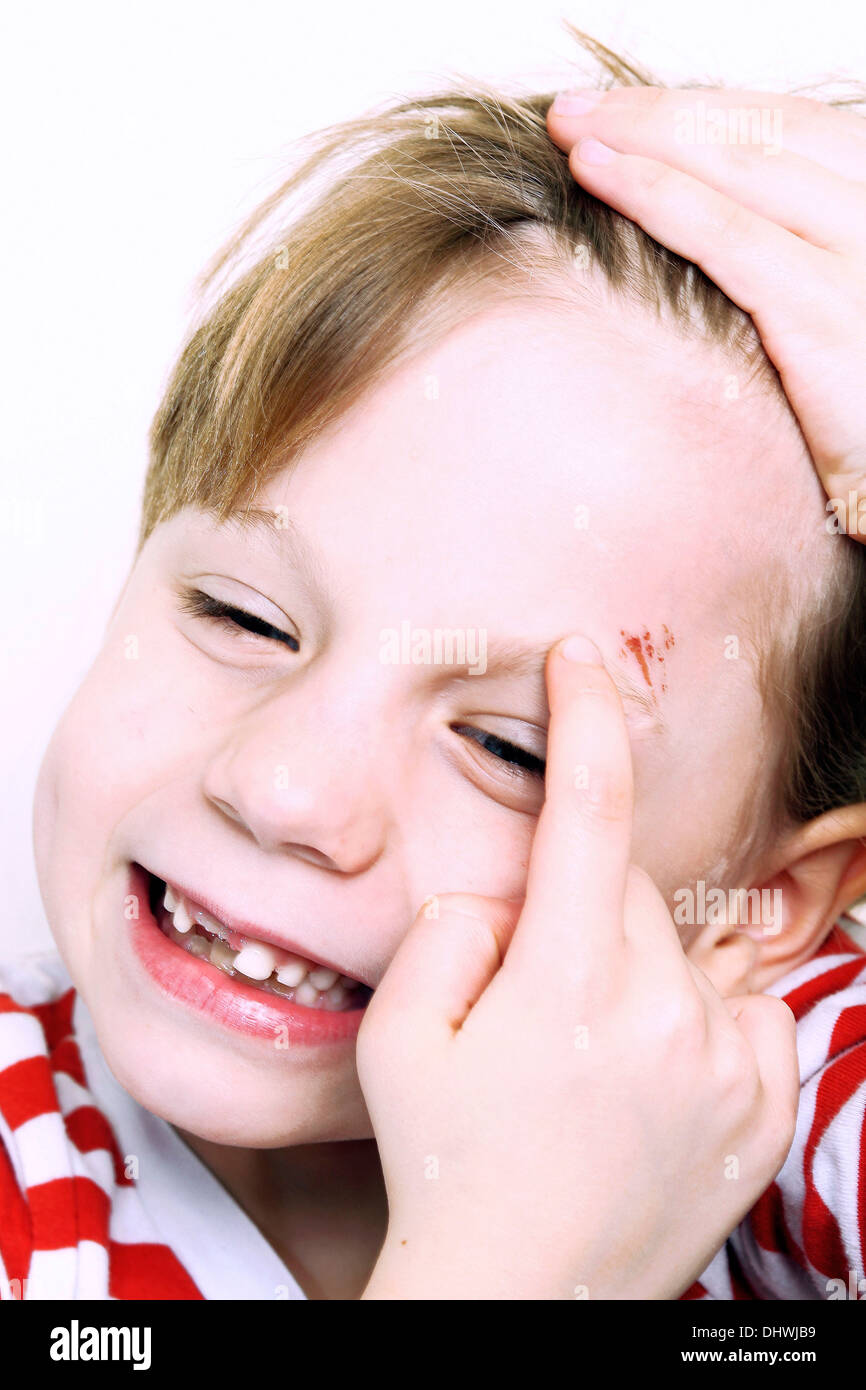 Injured child hi-res stock photography and images - Alamy