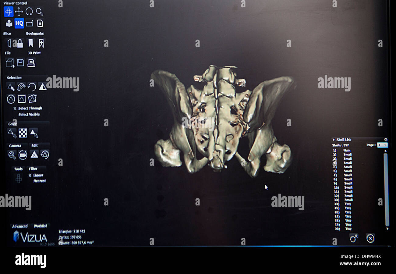 3d ct reconstruction hi-res stock photography and images - Alamy