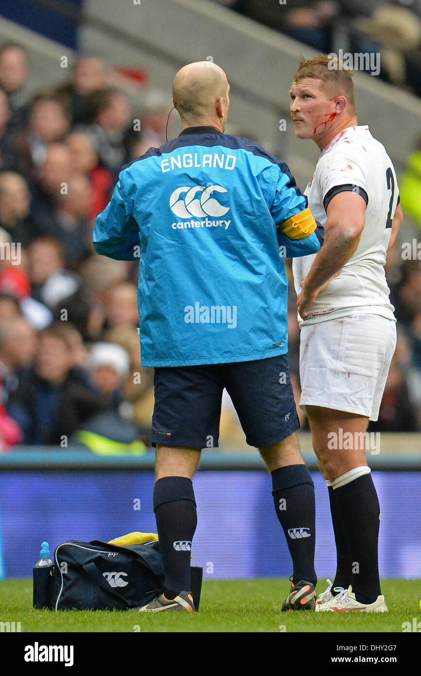 Twickenham, UK. 16th Nov, 2013. England's Dylan Hartley, gets treated ...