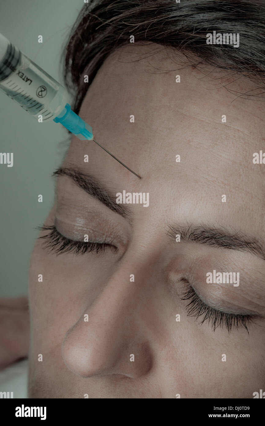 Botox forehead hi-res stock photography and images - Alamy