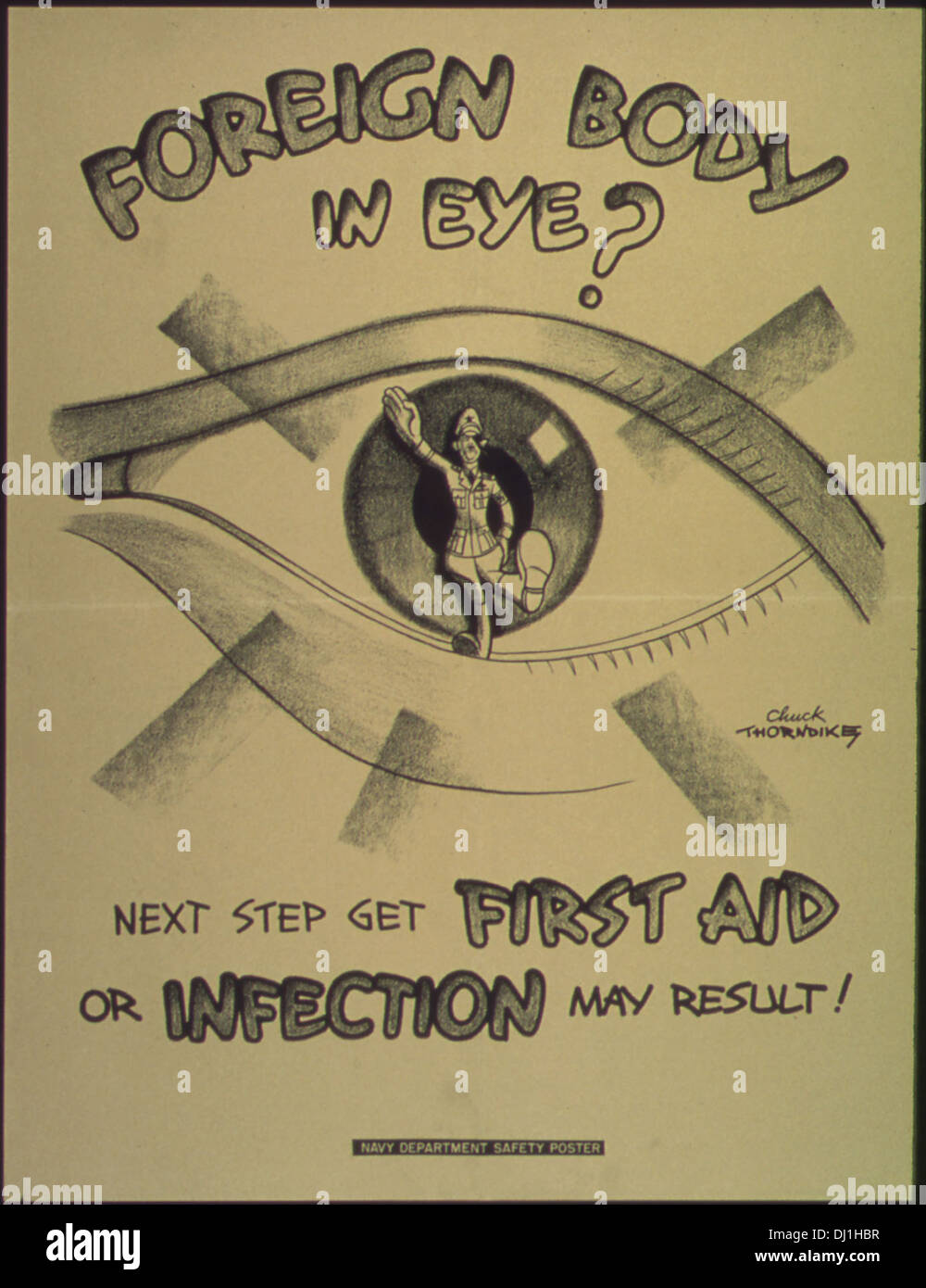 First Aid For Foreign Object In Eye