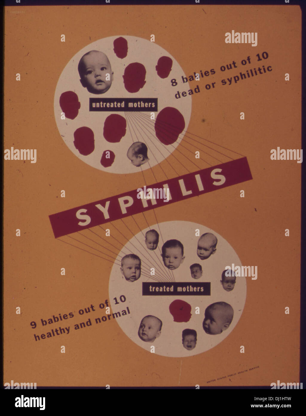 Syphilis Poster High Resolution Stock Photography and Images - Alamy