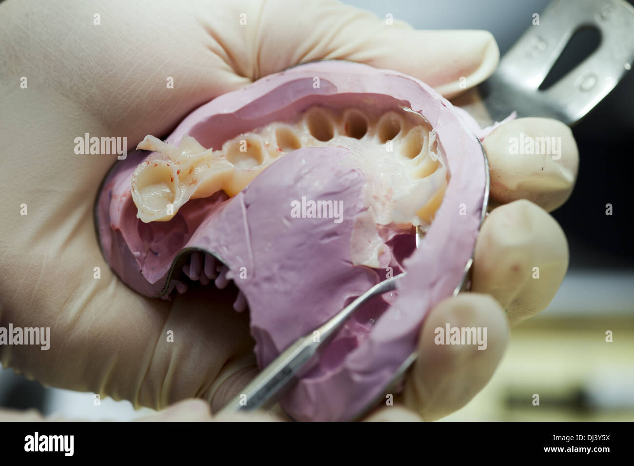 Temporary removal of a maxillary impression Stock Photo - Alamy