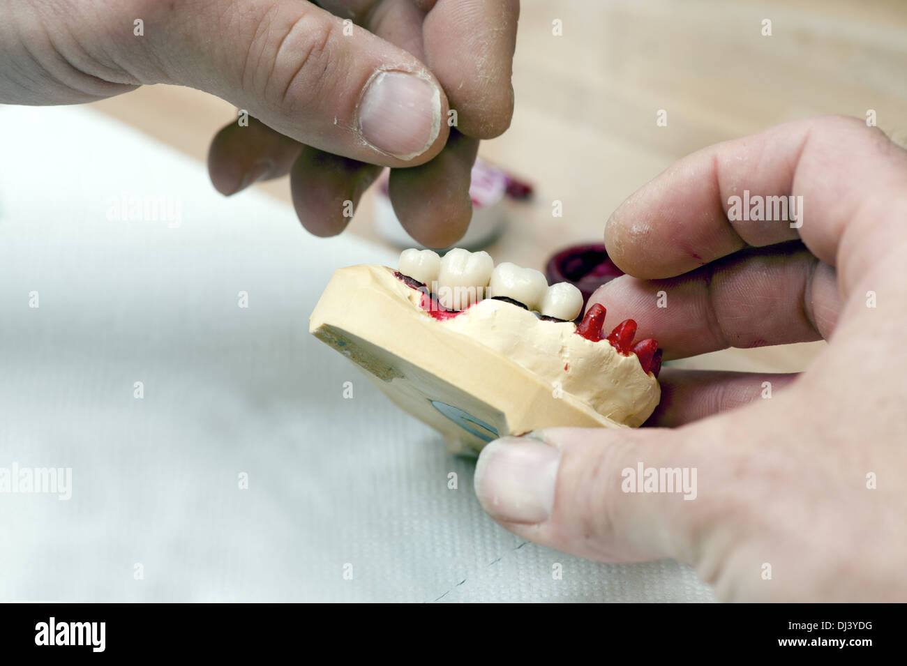 Upper jaw model with attached crown Stock Photo - Alamy
