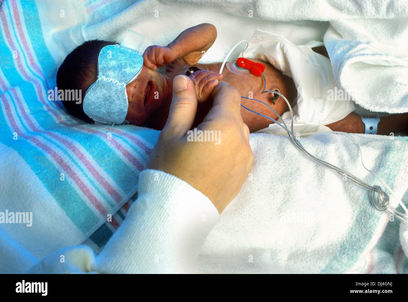 A premature baby holds Mother's hand in Neonatal Intensive Care Unit ...