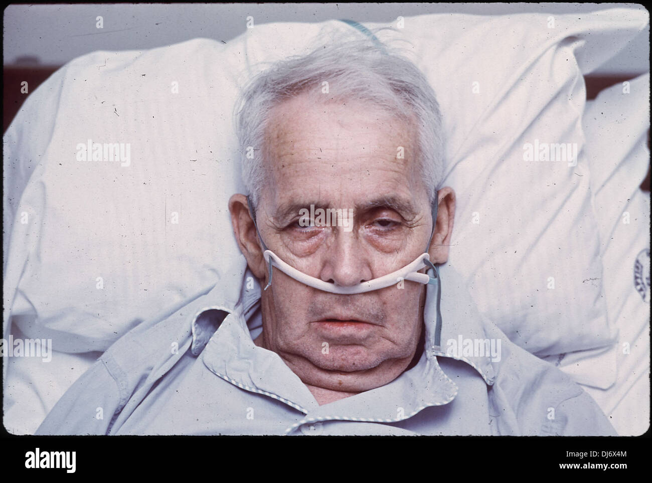 Patient with damaged lung hi-res stock photography and images - Alamy