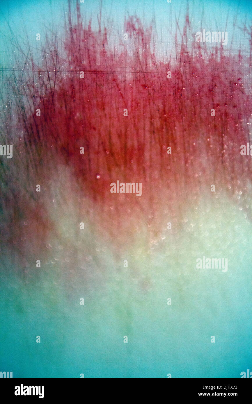 Blood scratch hi-res stock photography and images - Alamy
