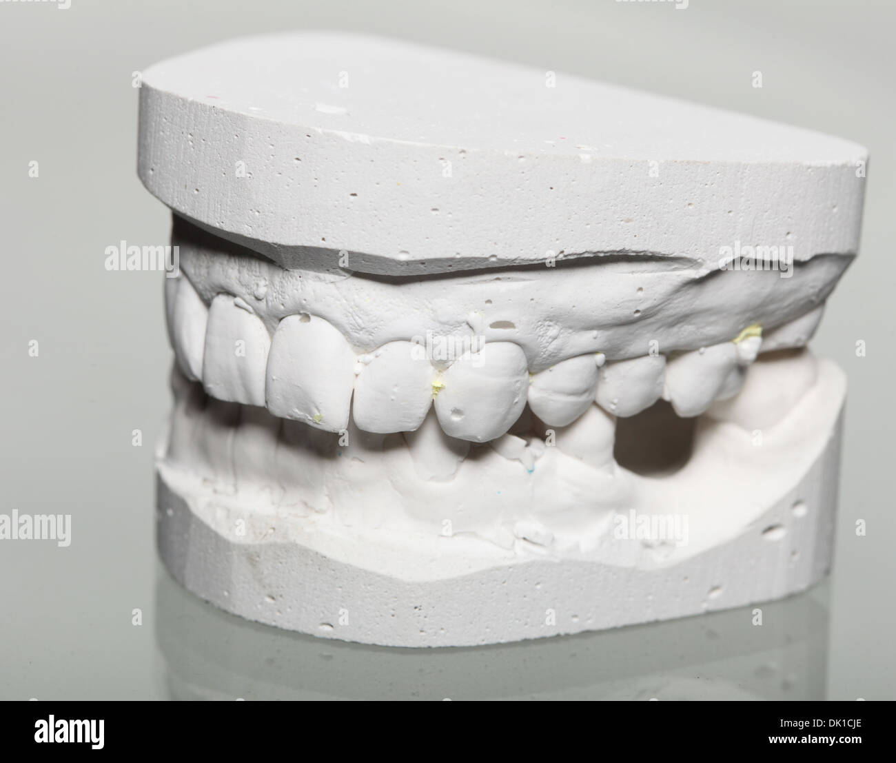 Dental casting gypsum model plaster cast stomatologic human jaws ...