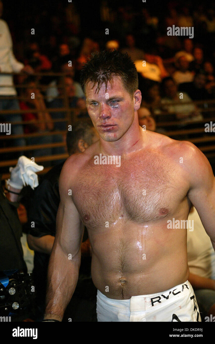 Apr 05, 2007 - Las Vegas, NV, USA - ANTONI HARDONK sporting a black eye ...