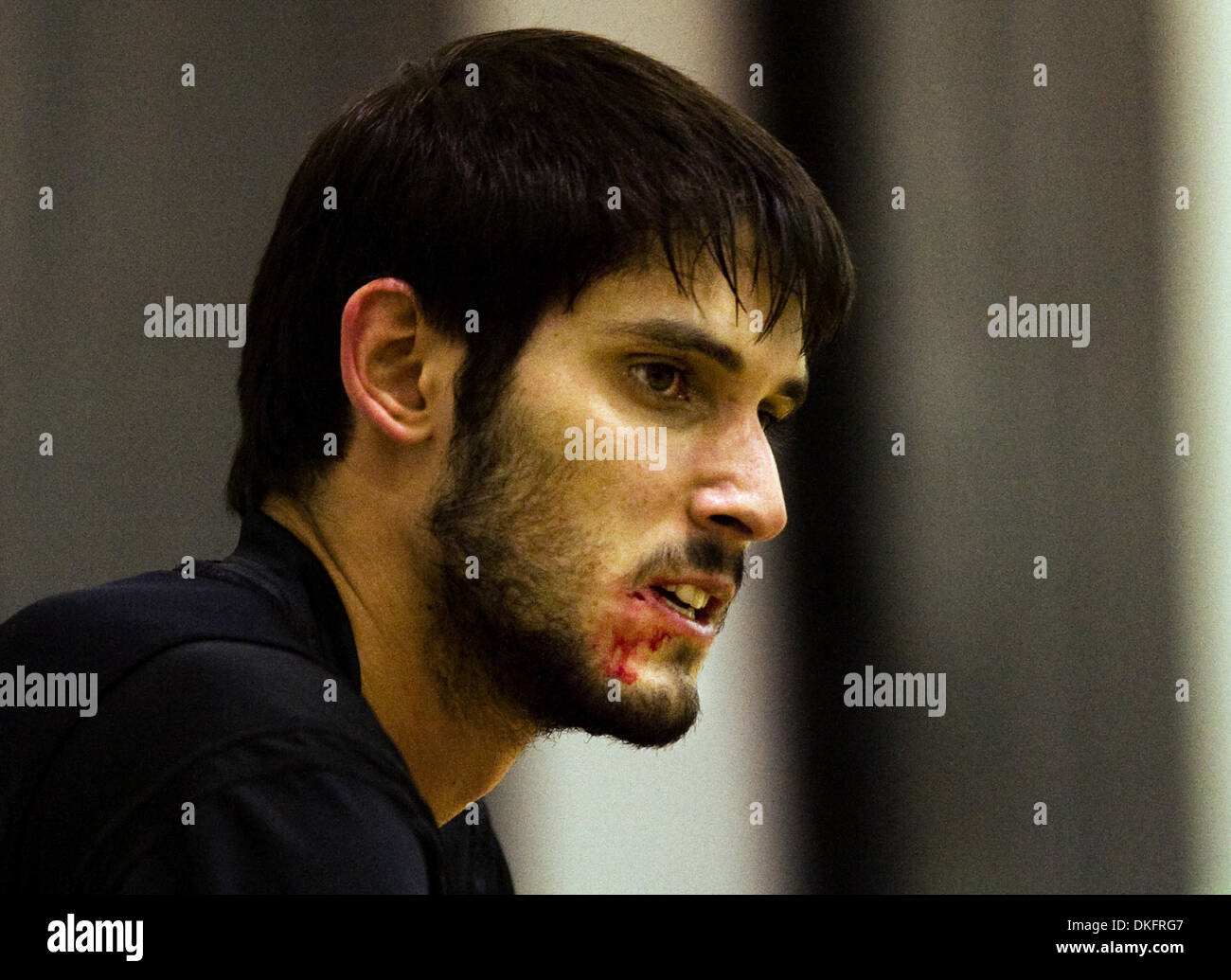 Split lip hi-res stock photography and images - Alamy