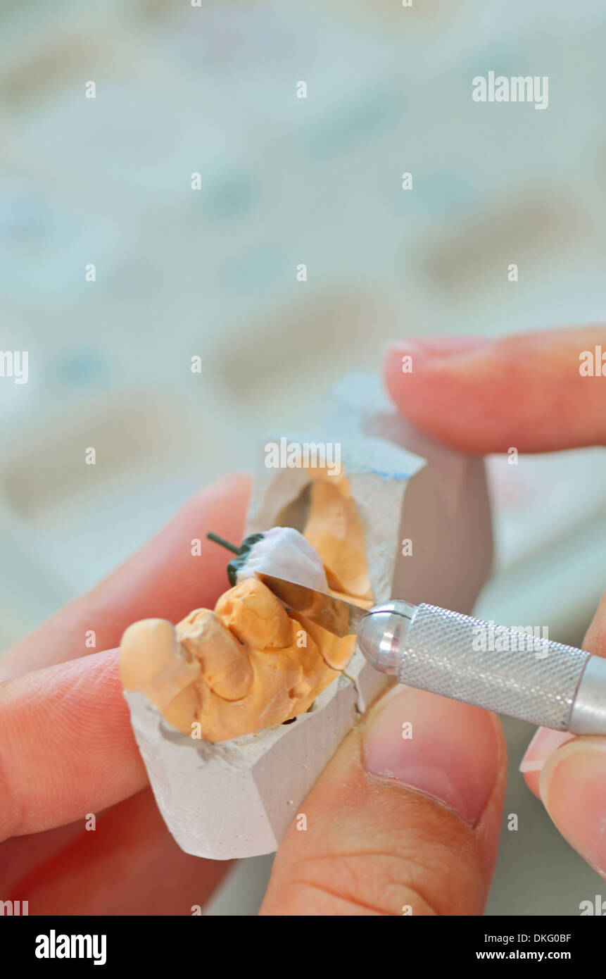 Ceramic inlay hi-res stock photography and images - Alamy