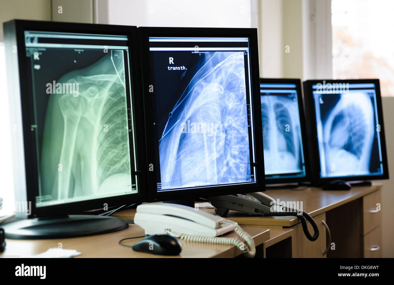 Radiography of human body parts Stock Photo - Alamy