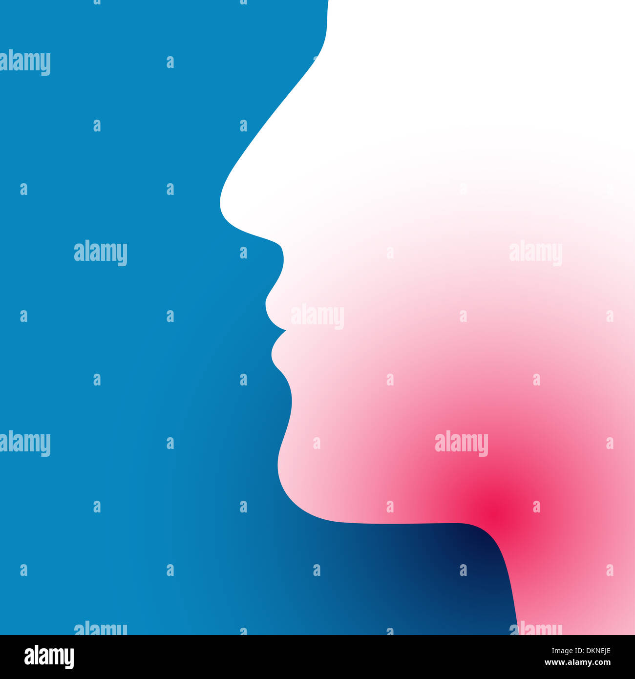 Illustration of sore throat on blue background Stock Photo - Alamy