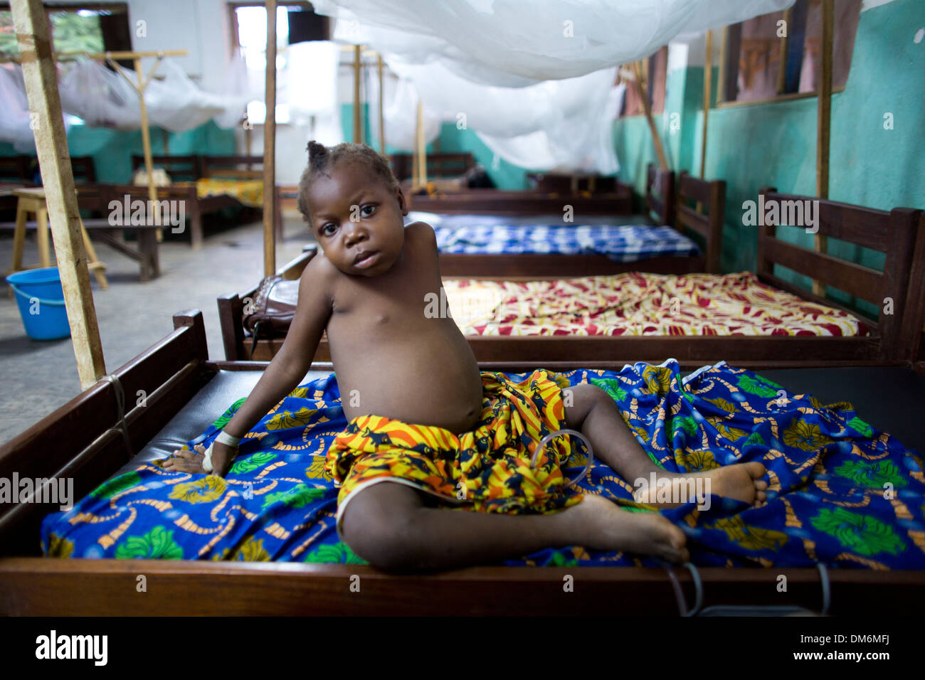 Emaciated patient hi-res stock photography and images - Alamy