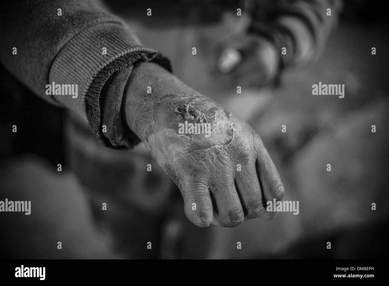 Romanian orphans hi-res stock photography and images - Alamy