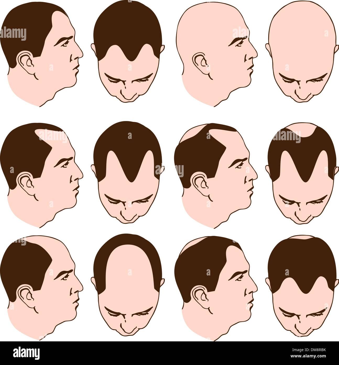 Hairlines Types For Women