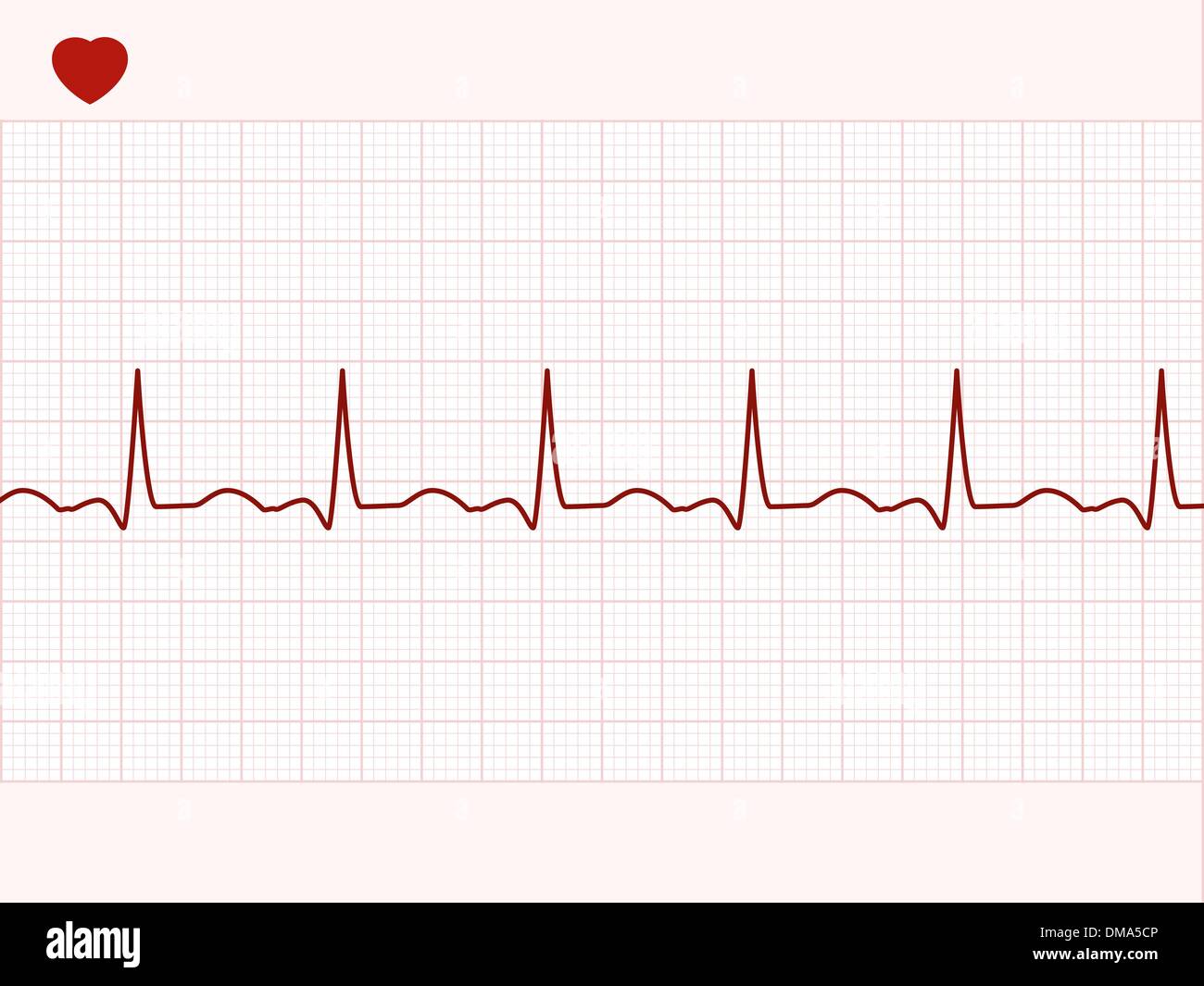 Normal electrocardiogram hi-res stock photography and images - Alamy