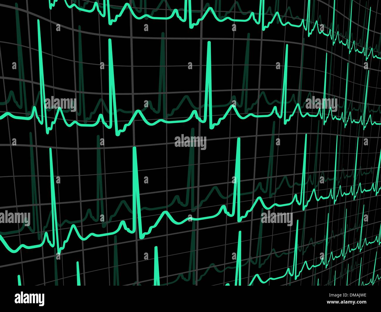 Heart monitor screen hi-res stock photography and images - Alamy