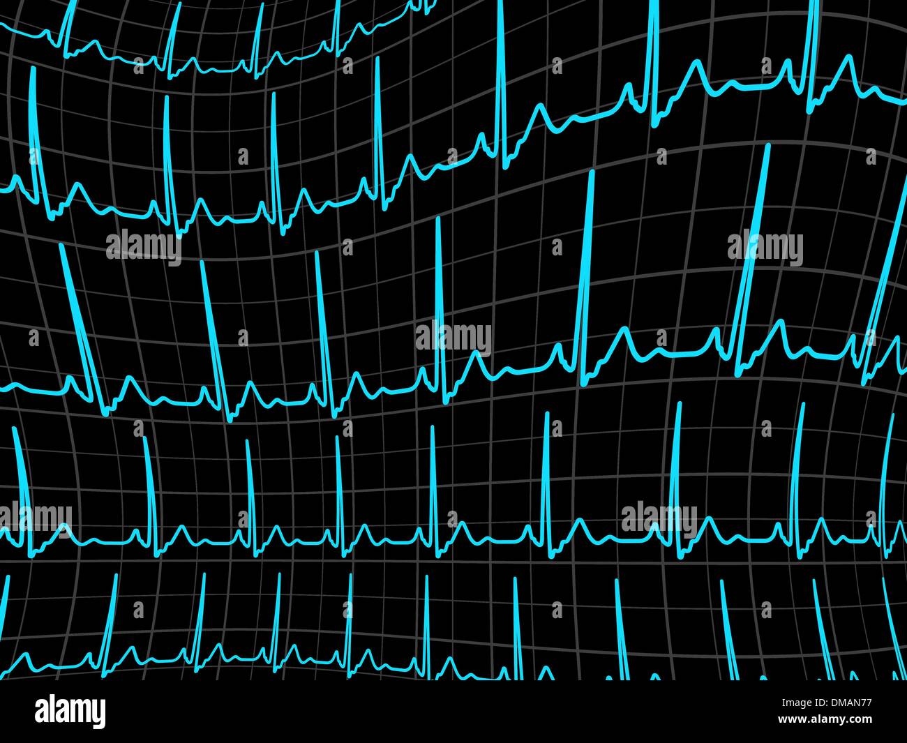 Ecg heart tracing hi-res stock photography and images - Alamy