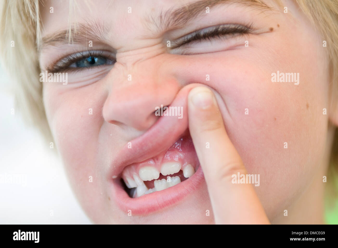 A young child shows off his teeth Stock Photo - Alamy