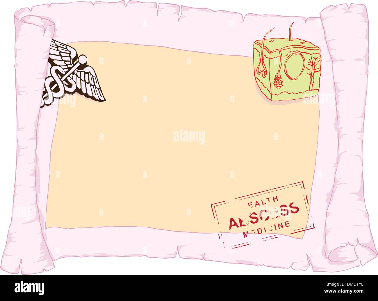 Abscess hi-res stock photography and images - Alamy