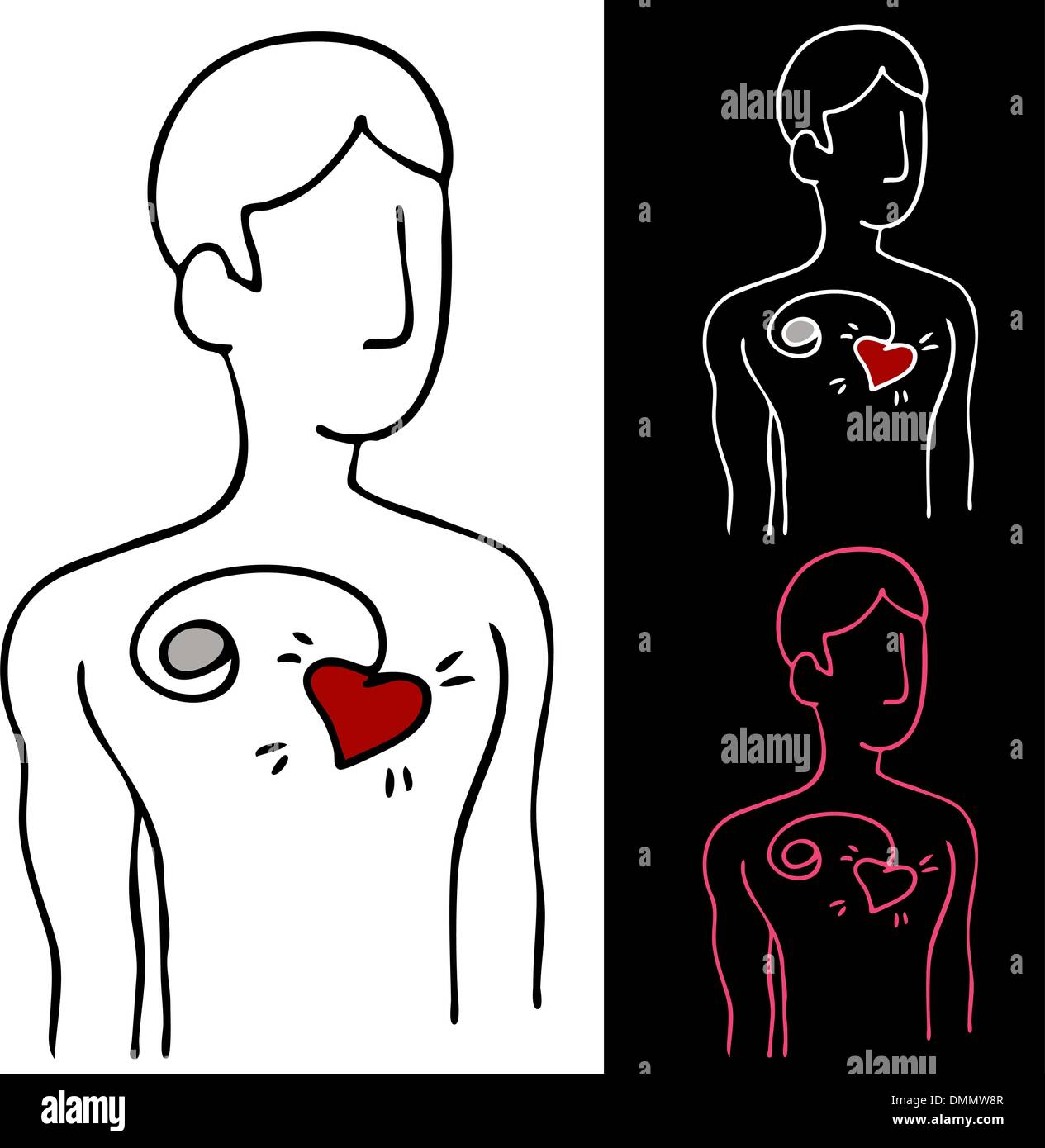 Pacemaker Stock Vector Images - Alamy